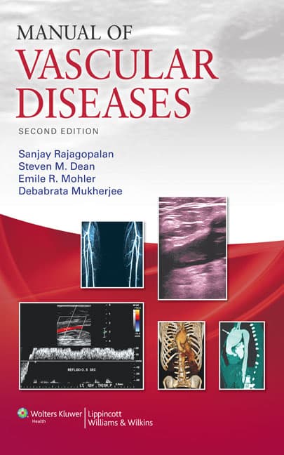 Manual Of Vascular Diseases